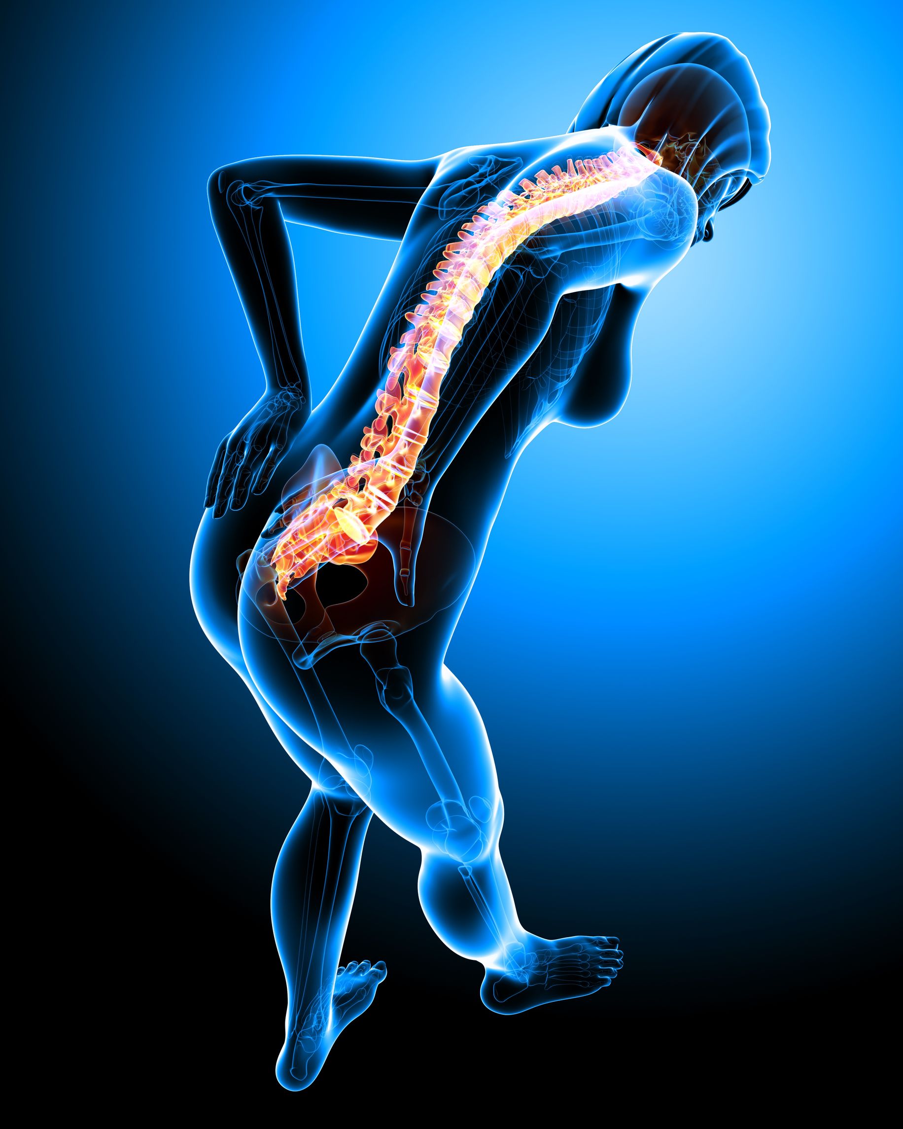 Lumbago – Cause & Solution – BeatingBackPain